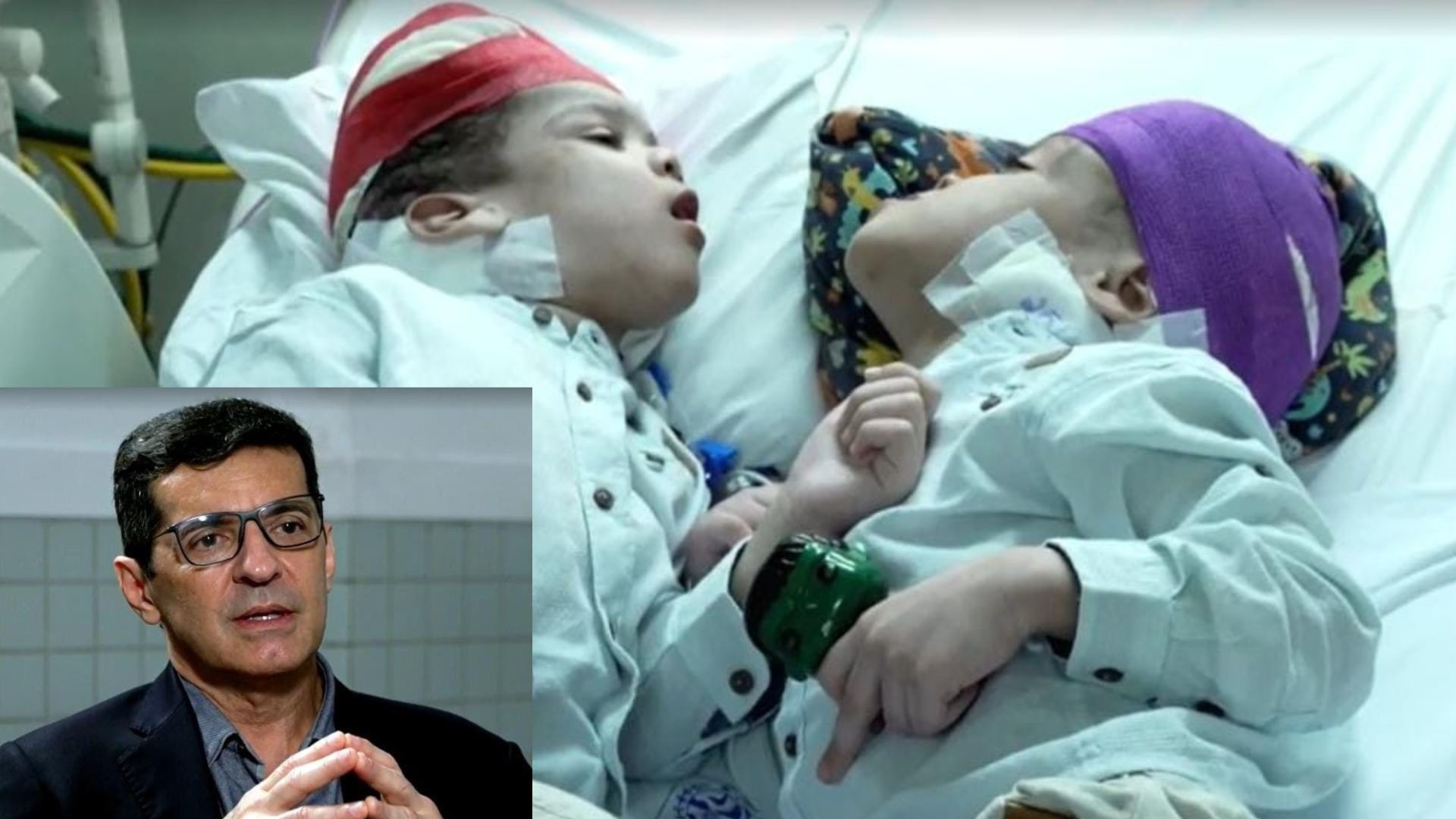 O Que A Bíblia Diz Sobre Gêmeos Siameses - RETOEDU